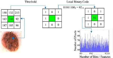 Figure 1 From Automatically Diagnosing Skin Cancers From Multimodality Images Using Two Stage