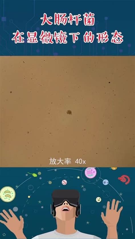 大肠杆菌在显微镜下的形态。腾讯视频