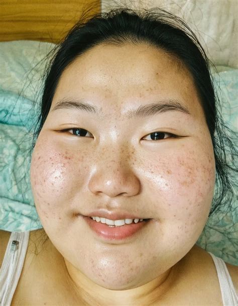 Selfie Of A 20 Year Old Obese Mongolian Woman 、smile、nostril Seaart Ai