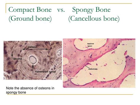 Spongy Vs Compact Bone Histology