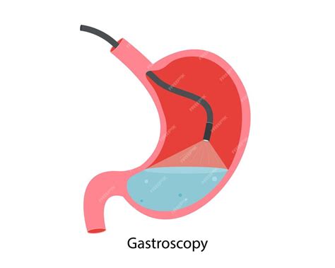 Premium Vector Gastroscopy Procedure Research Of A Stomach Gastroscope Disease Of The Stomach