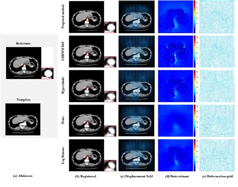 Figure 10 From A Bi Variant Variational Model For Diffeomorphic Image