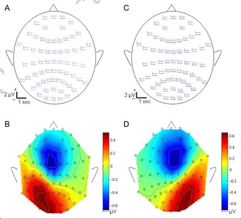 Scalp Distribution Of Touch Evoked Potentials All Trials Of One Hand Download Scientific