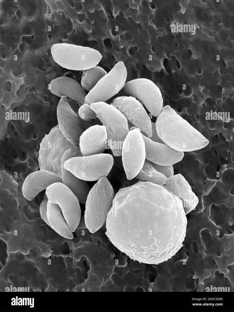 Parasitic Tachyzoites Trophozoites That Cause Toxoplasmosis In Humans