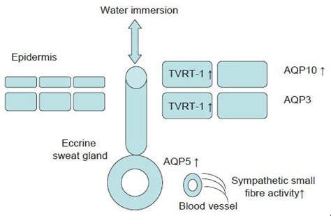 Aquagenic Keratoderma Two New Case Reports And A New Hypothesis Pmc
