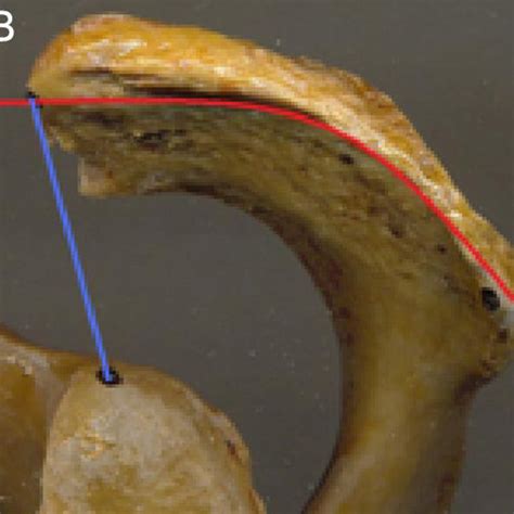 Descriptive Analysis On The Angles And The Distance Da In Relation To Download Table
