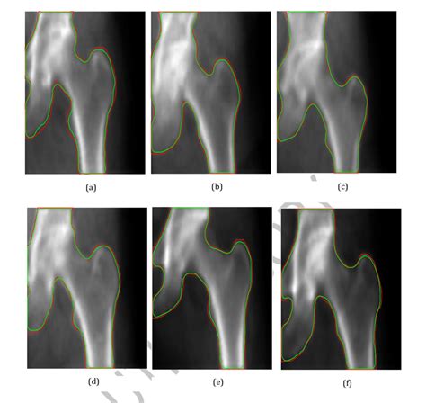 Pixel Label Random Forest Results Boundaries Using Pixel Label Random