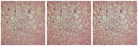 Demonstration Of The Multifocus Fusion Algorithm Left Panel Image Of