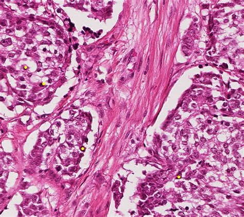 Notmitosisdetection Object Detection Dataset By Hifza