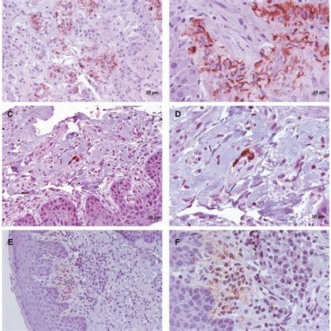 Immunohistochemical Distribution Of Prp Sc Through Peripheral Tissues Download Scientific