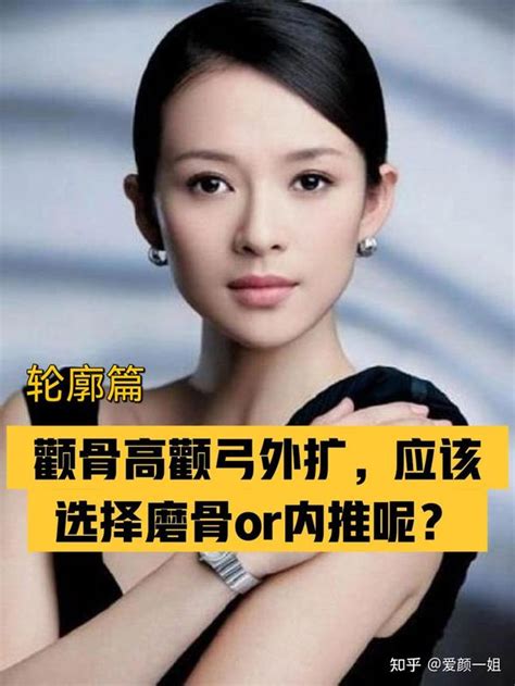 科普颧骨高颧弓外扩选择磨骨or内推 知乎