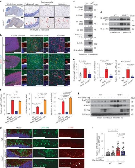 Innate Immune Sensing Of Lysosomal Dysfunction Drives Multiple Lysosomal Storage Disorders