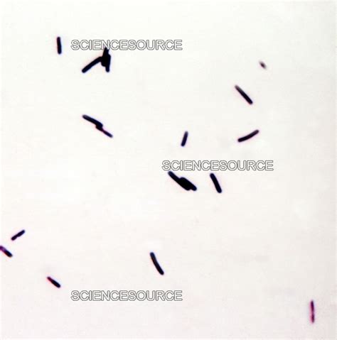 Clostridium Difficile Bacteria Light Stock Image Science Source Images