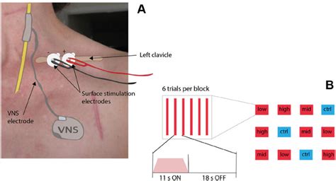 Experimental Design Pupil Size Was Recorded Upon 4 Stimulation Download Scientific Diagram
