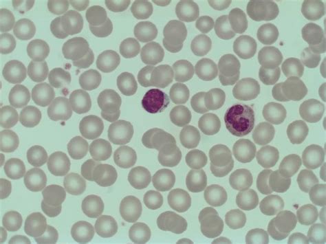 Tesis Classification Dataset And Pre Trained Model By Linfos