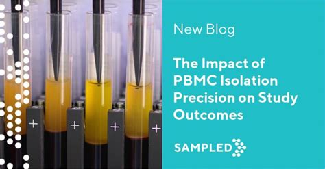 Sampled On Linkedin Pbmcisolation Drugdevelopment Immunology