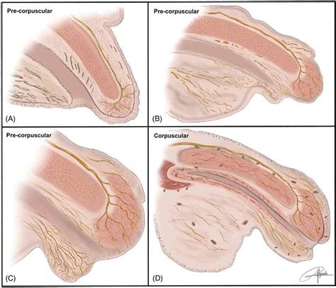 Frenular Delta Anatomy Sensitivity And Research Evidence Rathbiotaclan