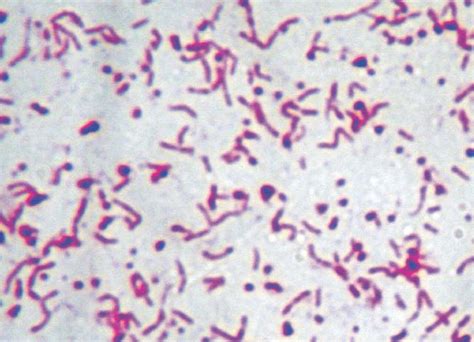 Corynebacterium Gram Stain