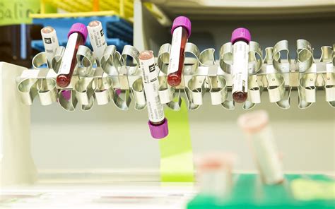 Technologie Danalyses Biomédicales Dec Cégep De Rosemont