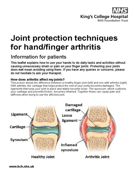 Pl 8401 Joint Protection Techniques For Hand Finger Arthritis