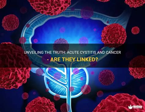 Unveiling The Truth Acute Cystitis And Cancer Are They Linked Medshun