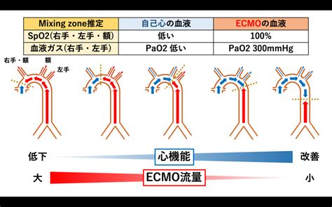 Mixing Zone もふごろ循環器のガチレビュー