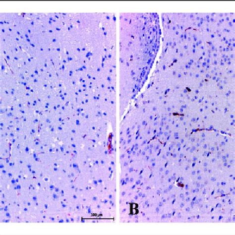 Histopathology Of Toxoplasmic Encephalitis Stained By Haematoxylin And Download Scientific