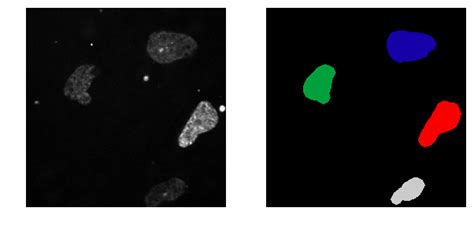 Individual Amoeboid Cells Imaged Via Brightfield Microscopy Are