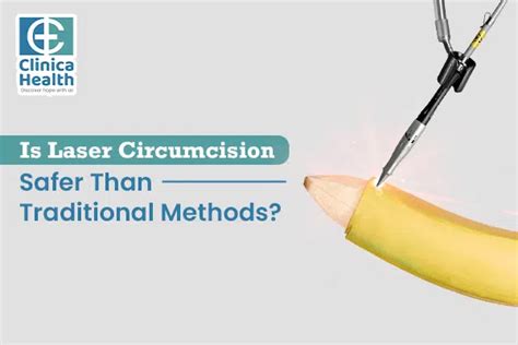 Laser Circumcision Vs Traditional Circumcision The Safer Option
