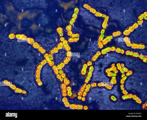 Streptococcus Pyogenes Gruppe A Fotos Und Bildmaterial In Hoher
