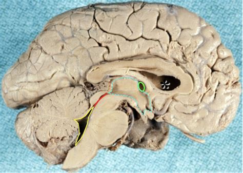Ventricular System Diagram Quizlet