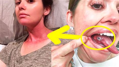 She Thought She Bit Her Tongue While She Was Asleep But She Discovered