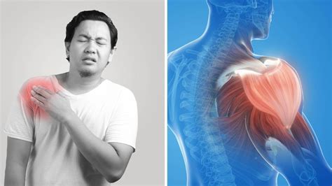 Shoulder Arthroscopy Specialist Doctor And Surgeon Treatment