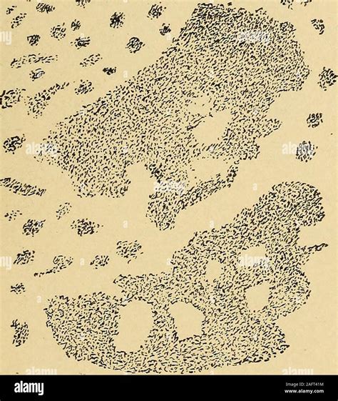 Amorphous Urate Crystals