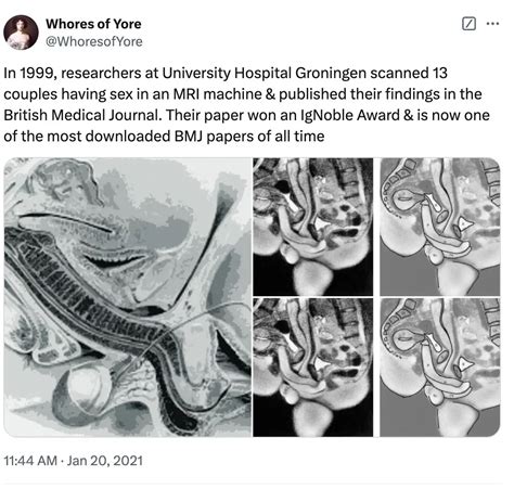 Mindblowing Mri Images Reveal What Really Happens In The Body When You Have Sex