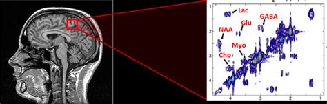Sparse Fourier Transform Gives Stream Processing A Lifeline From The Coming Data Deluge