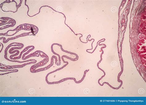 Uterus Human Uterine Tube Human Placenta Human And Umbilical Cord