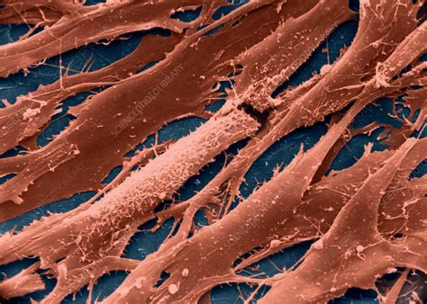 Fibroblasts Sem Stock Image C030 5194 Science Photo Library