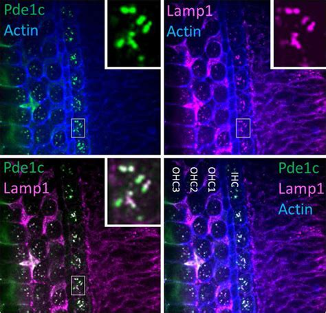 Wholemount Immunofluorescence On P3 Mouse Cochlea The Panel Reveals A