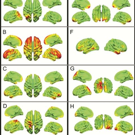 Pdf Reconstructing Large Scale Brain Resting State Networks From High Resolution Eeg Spatial