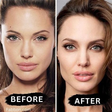 17 Celebrities Who Have Had Buccal Fat Removal 2025 Fabbon