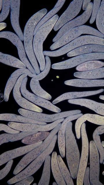 Spirostomum Sp Under Microscope A Glimpse Into The Microworld