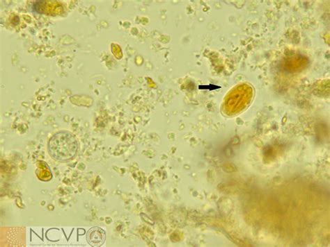 Flagellates