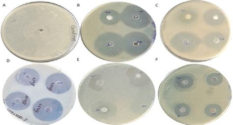 Antibacterial Activity Of M Oleifera Seed Extract Against Selected