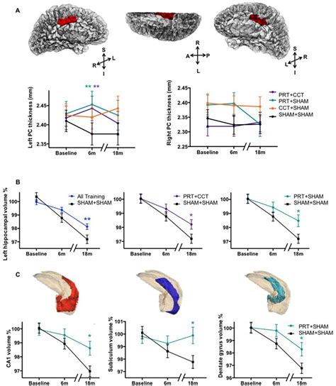 resistance exercise preserves and protects alzheimer vulnerable