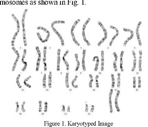 Figure 1 From Classification Of Metaphase Chromosomes Using Deep Learning Neural Network