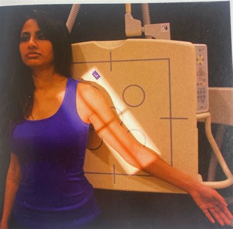 Humerus Flashcards Quizlet