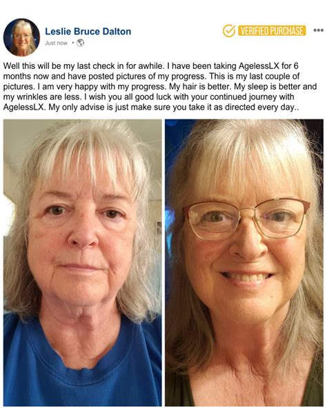 Your Premature Aging Score Agelesslx