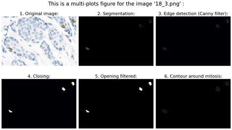 Automated Mitosis Detection And Analysis In Histological Images Using Opencv And Image