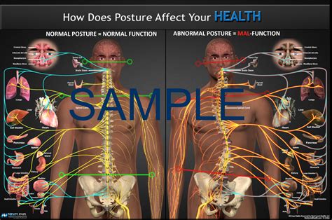 Posture Poster 24x36 Digital Download Ortho Integrative Medicine